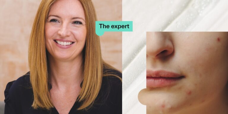 Your Acne Routine - SkinLab