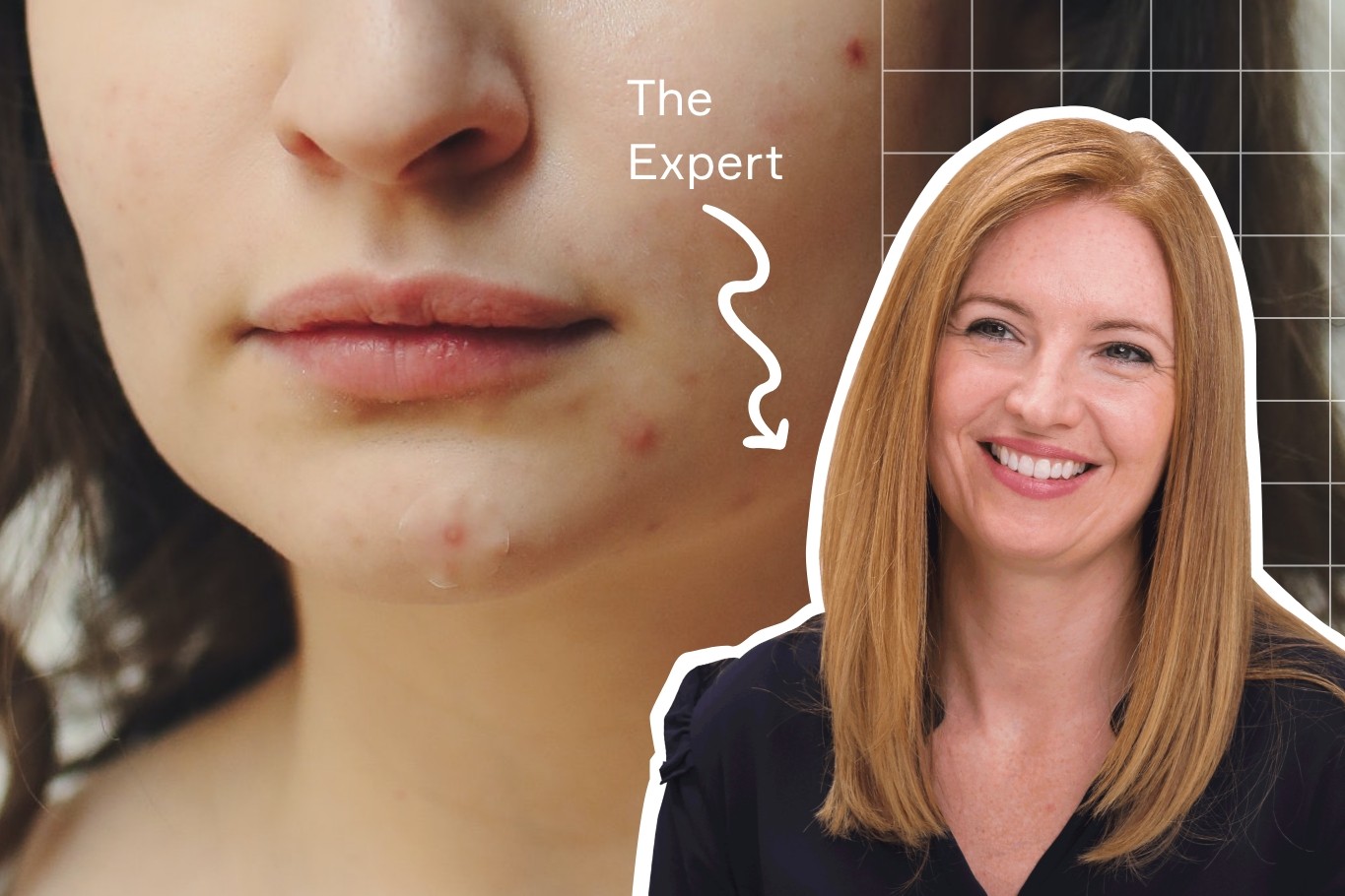 How To Start A Retinoid - The Skin Lab