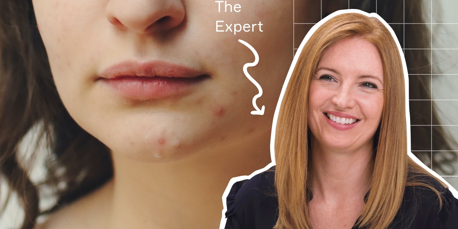 Your Side Effects - The Skin Lab