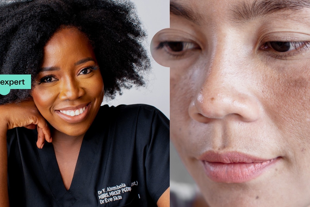Ask a Derm: Can Skin Conditions Affect Black People Differently? With ...