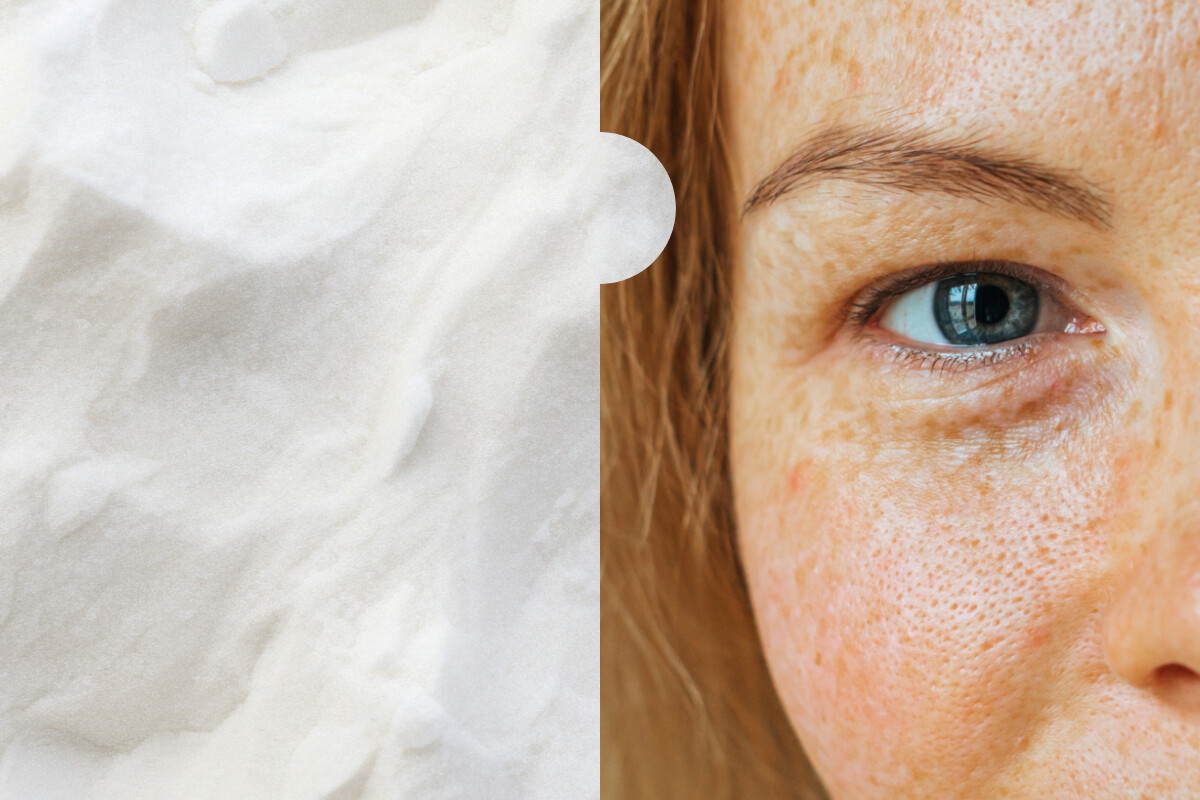 Pseudofolliculitis barbae: How to prevent spots in your beard - SkinLab