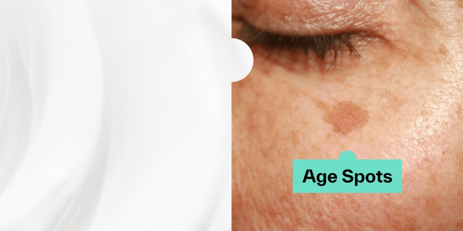 Mythbusting: Can You Remove Age Spots Naturally? - SkinLab