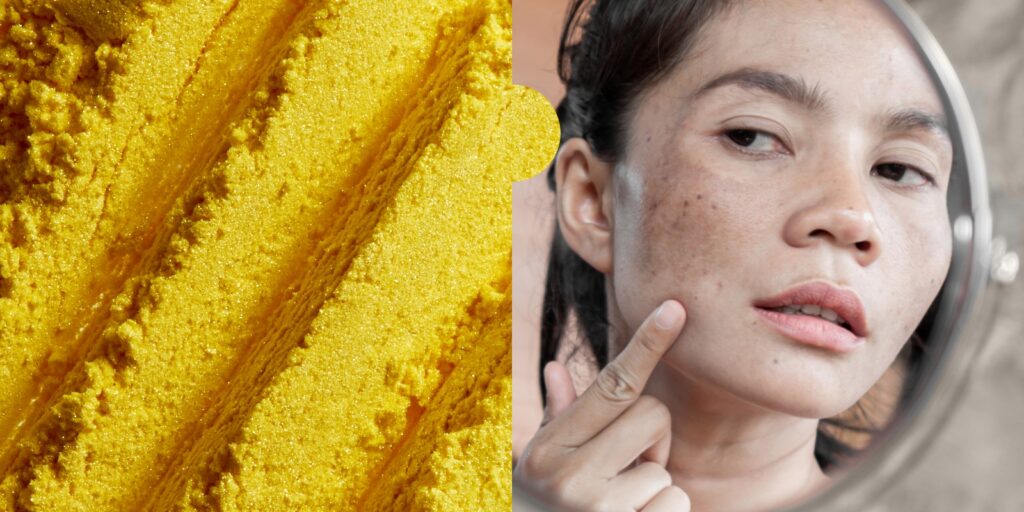 Does Retinol Treat Sun Damage? - SkinLab