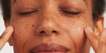 How To Tell If Your Skin Is Stressed (And What To Do About It) - SkinLab